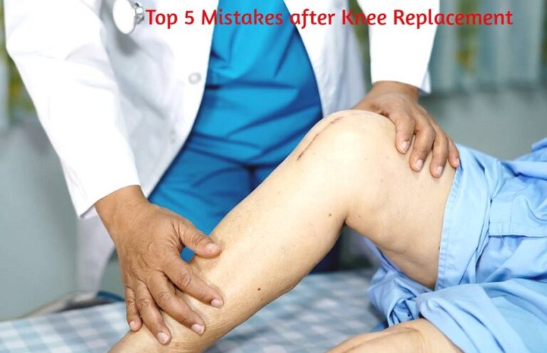 Top 5 Mistakes after Knee Replacement with Solutions